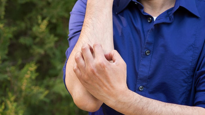 Skyrizi Side Effects: 7 Things to Look Out for - GoodRx