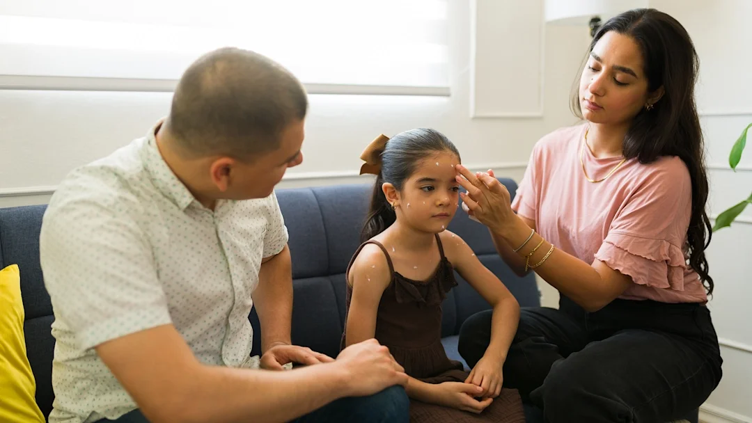 What Does Chickenpox Look Like? Signs and Images - GoodRx