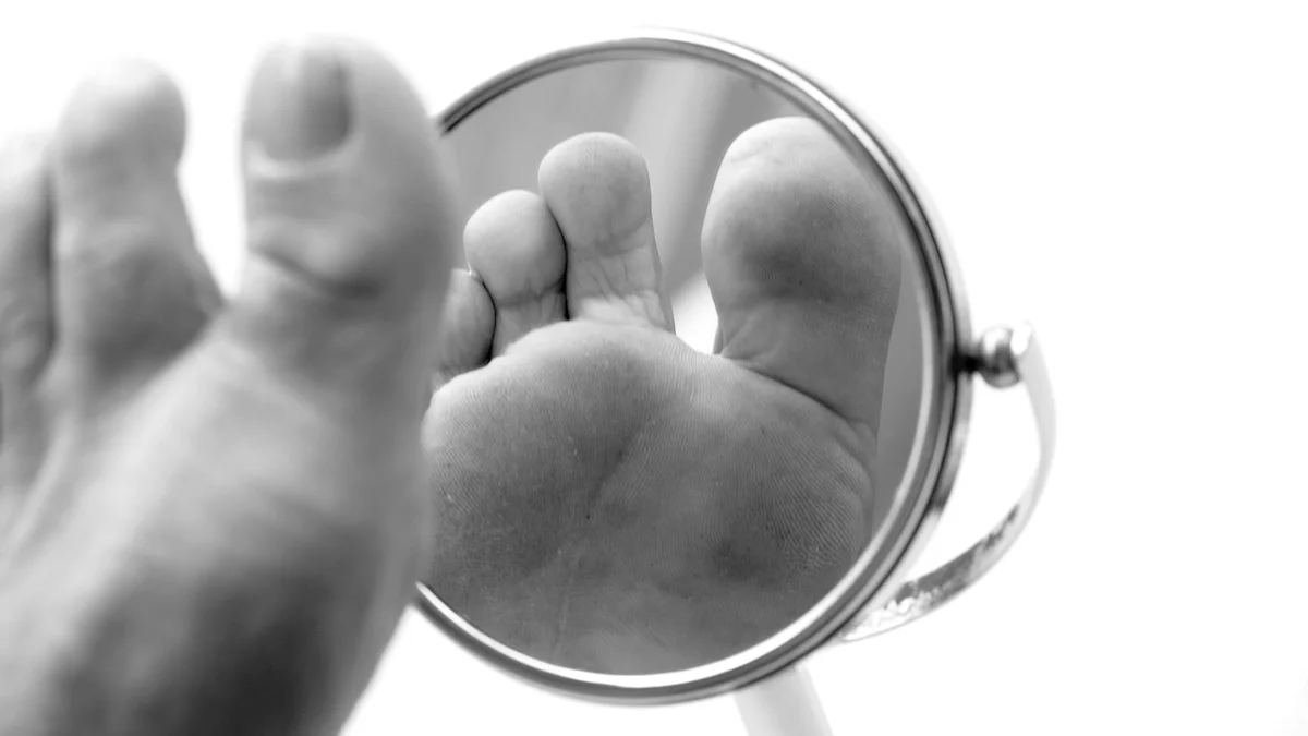 Diabetes Rash: Photos, Causes, and Care - GoodRx