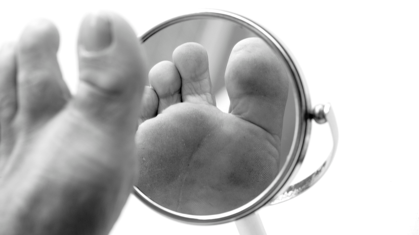 Diabetes Rash: Photos, Causes, and Care - GoodRx