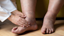 9 Foot Drop Exercises That Can Help You Heal Faster - GoodRx