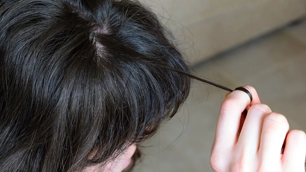 Hair Pulling Disorder: Causes and Treatment for Trichotillomania - GoodRx