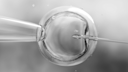 5 Reasons to Have a Salpingectomy (and What’s Involved) - GoodRx