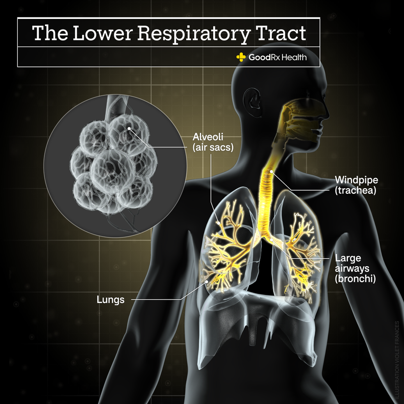 7 OTC Medications and Self-Care Treatments for Bronchitis - GoodRx
