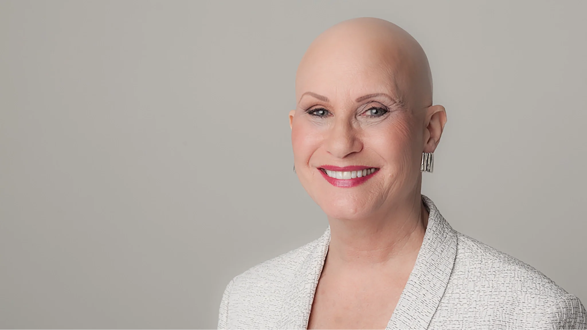 Living With Alopecia Areata: Coming to Terms With Hair Loss - GoodRx