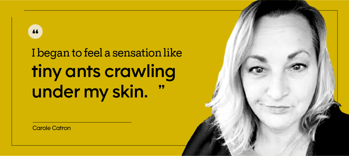 What Does a Bee Sting Feel Like? - GoodRx