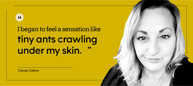 What Does a Bee Sting Feel Like? - GoodRx