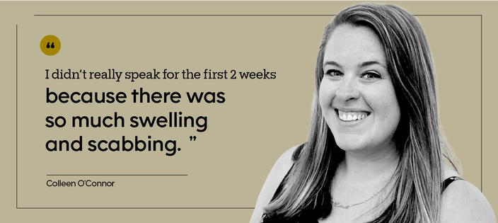 Tonsil Surgery Quotes Adult Tonsillectomy