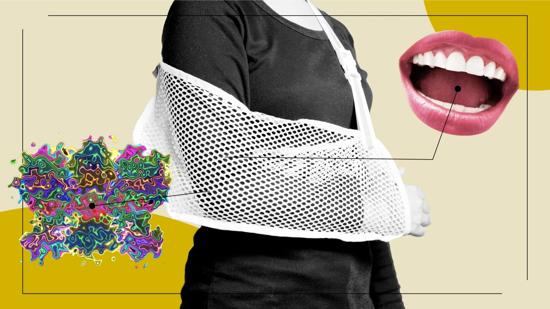 Does Breaking a Bone Hurt? 3 People Describe the Feeling - GoodRx