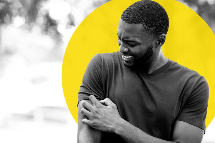 What is Topical Steroid Withdrawal (TSW)? Symptoms and Treatment - GoodRx