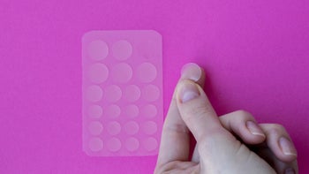 What Is Acne? Symptoms, Causes, Treatments, & More - GoodRx