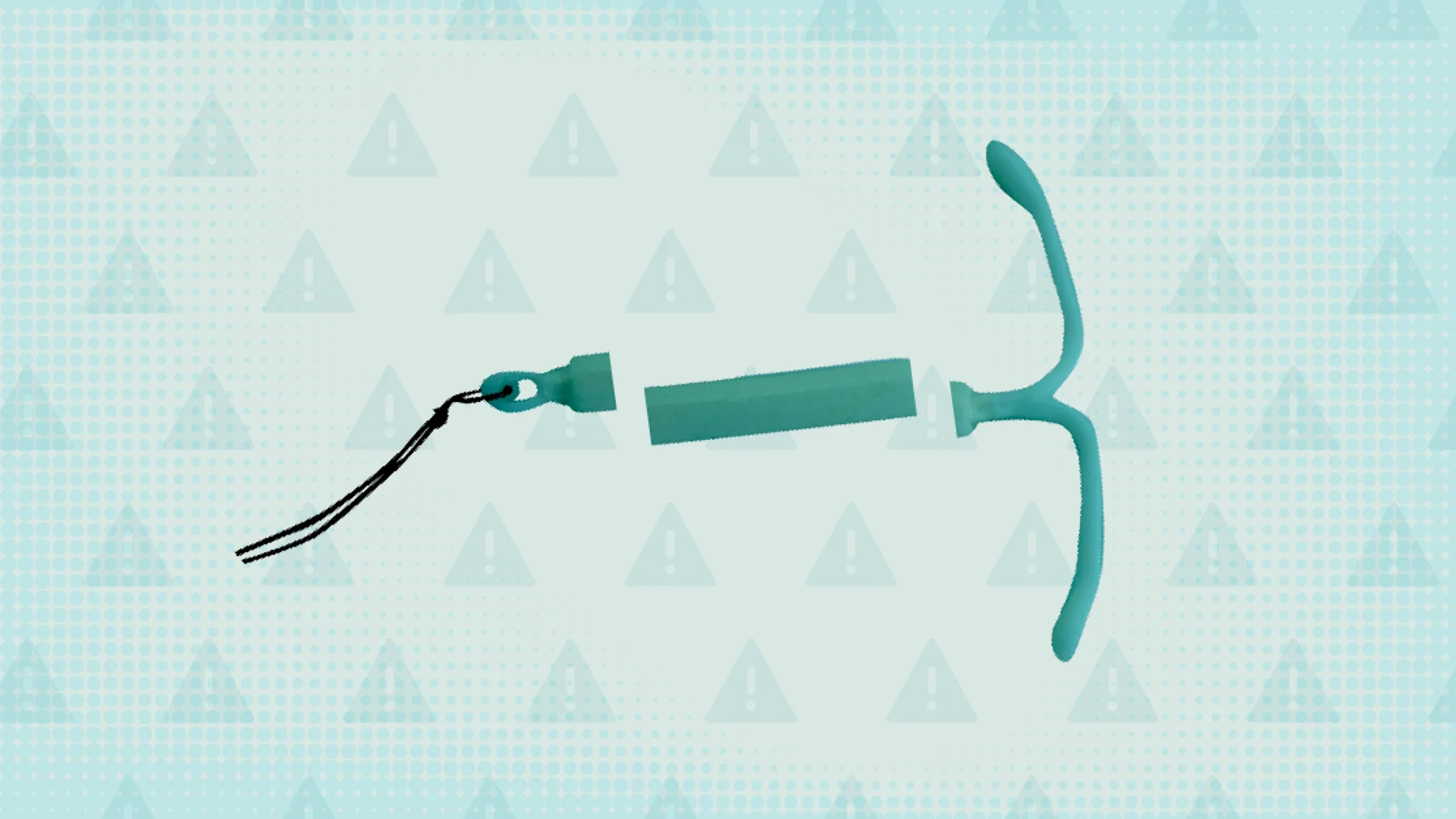 8 Mirena Side Effects & How to Manage Them - GoodRx