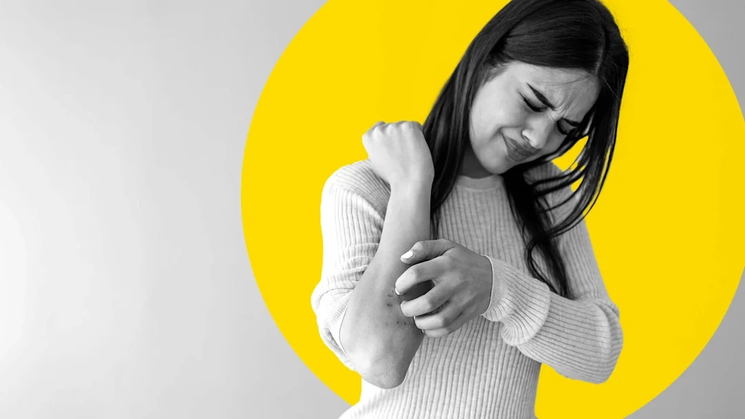 What Is Formication? Causes, Symptoms, and Treatment - GoodRx