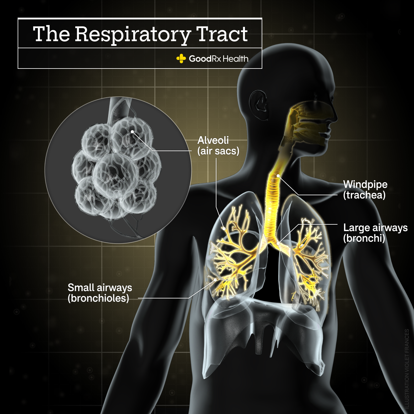 What Is COPD? Symptoms, Stages, Medications, & More - GoodRx