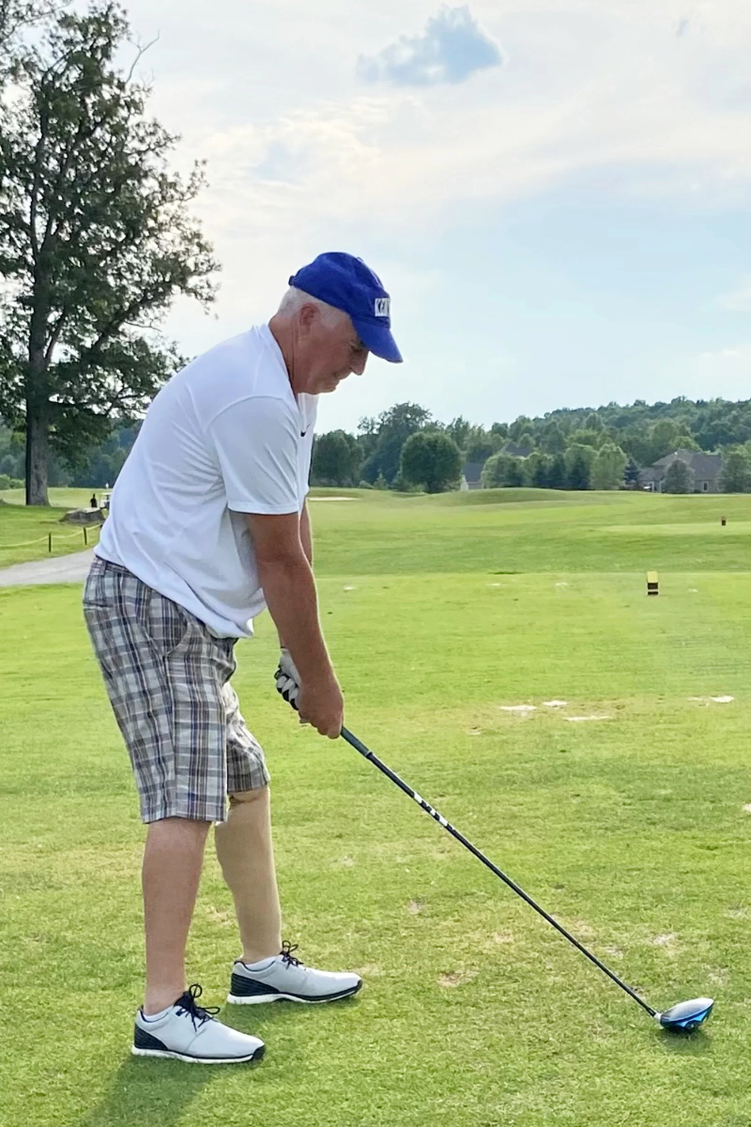 Living With a Prosthetic Limb - GoodRx