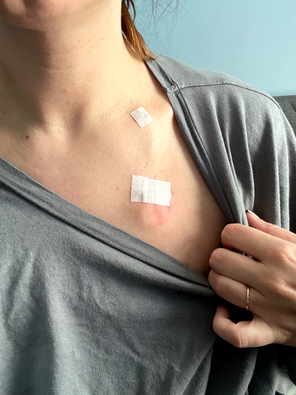 Here’s How to Sleep Better With a Chemo Port - GoodRx