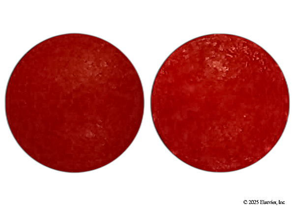 Ferrous Sulfate 2025 Prices, Coupons & Savings Tips - GoodRx