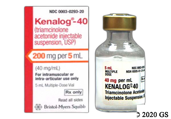 Kenalog Eye Injection