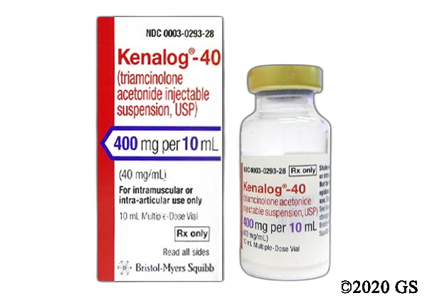 Kenalog Eye Injection